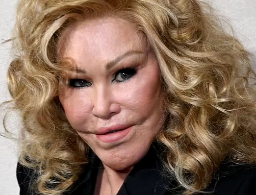 Socialite Jocelyn Wildenstein reveals her real face in photo taken ...